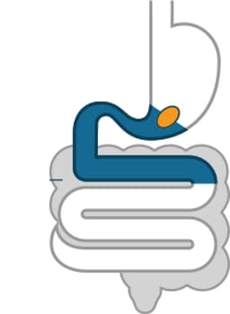 Mechanism of Delivery | GRALISE (gabapentin) tablets